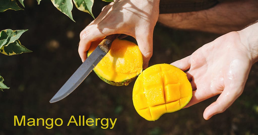 Mango Allergy – Symptoms, Tests and Treatments - Allergy Gate